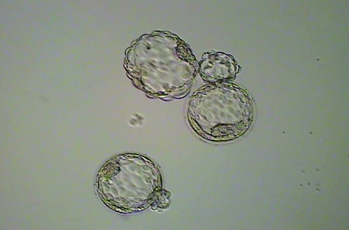 Advanced Embryo Culture | Northeastern Ohio Fertility Center